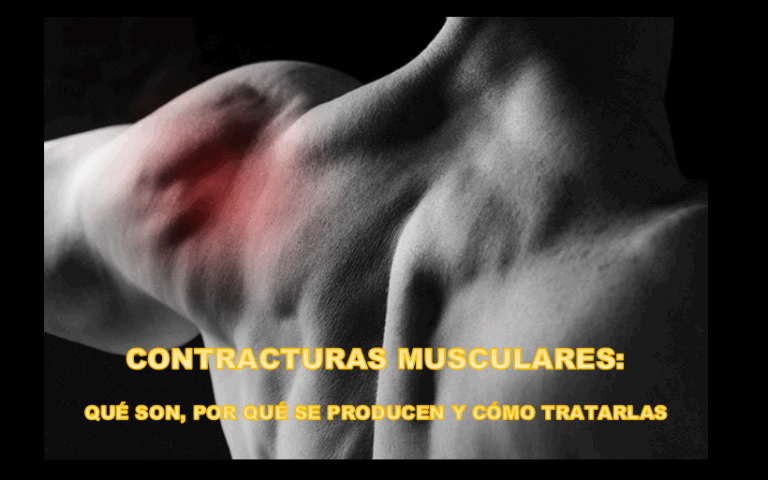 CONTRACTURAS MUSCULARES: QUÉ SON, POR QUÉ SE PRODUCEN Y CÓMO TRATARLAS ...